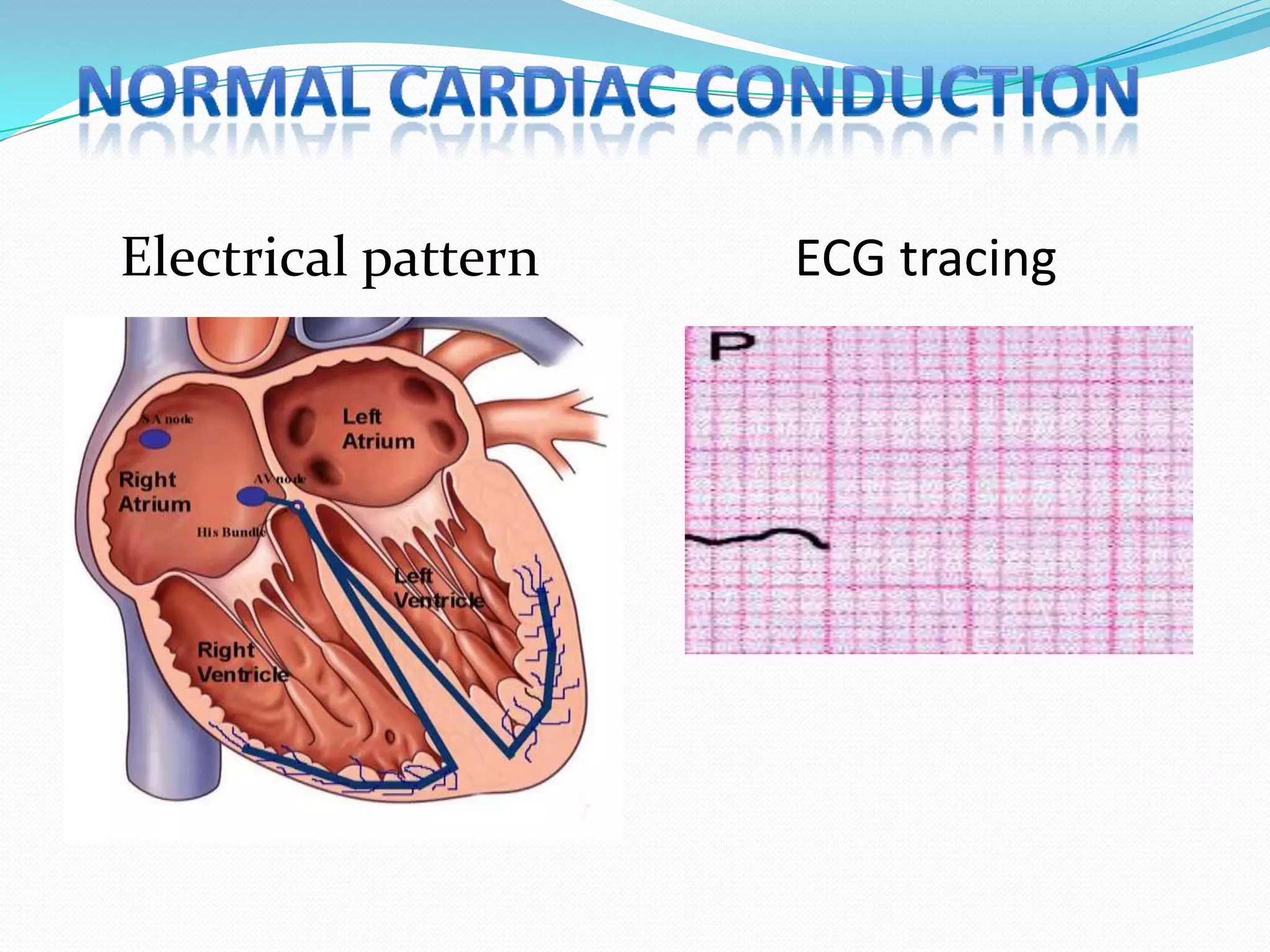 Defibrillator (ppt) | PPTX