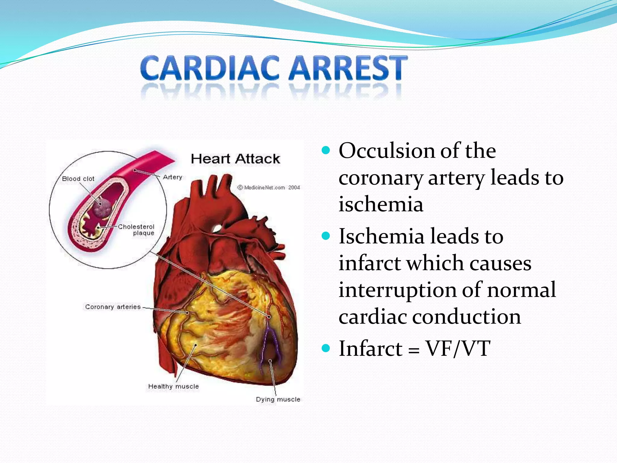 Defibrillator (ppt) | PPTX