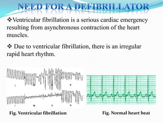 Defibrillator (ppt) | PPTX
