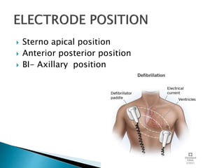 Defibrillator ppt.pptx