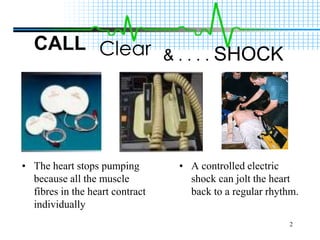 Defibrillators | PPSX