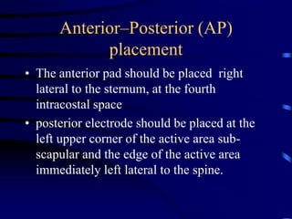 Defibrillators | PPT