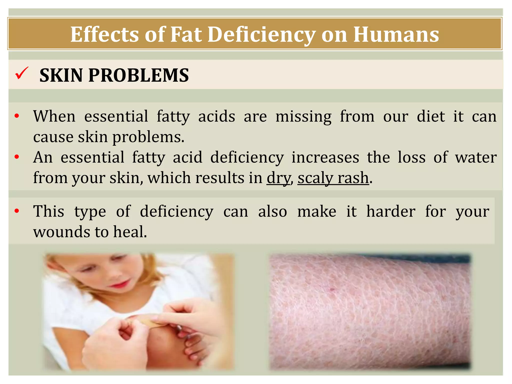 Deficiencies and Excesses of Fats | PPTX