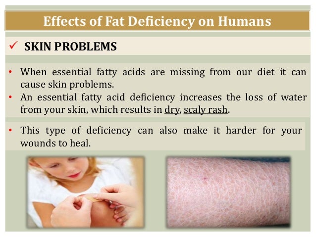 Deficiencies and Excesses of Fats