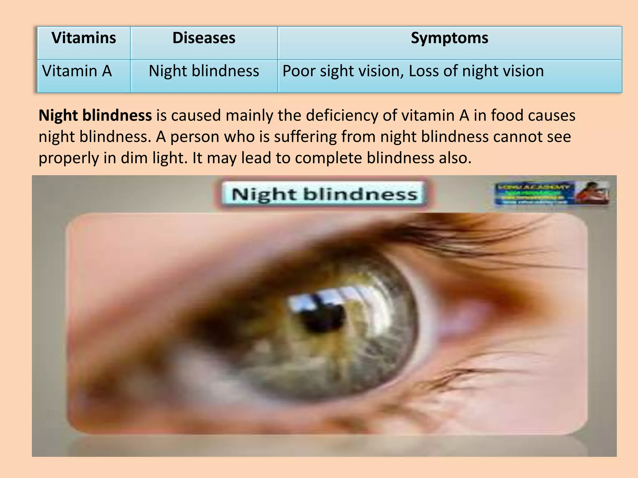 DEFICIENCY DISEASES IN NUTRITION- CLASS VI | PPTX