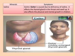 DEFICIENCY DISEASES IN NUTRITION- CLASS VI | PPTX