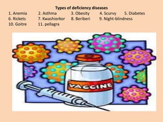 DEFICIENCY DISEASES IN NUTRITION- CLASS VI | PPTX