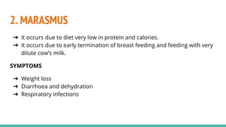 Deficiency diseases of proteins, kwashiorkor, marasmus | PPTX