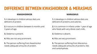 Deficiency diseases of proteins, kwashiorkor, marasmus | PPTX
