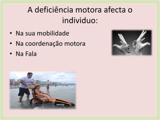 Deficiência motora | PPTX
