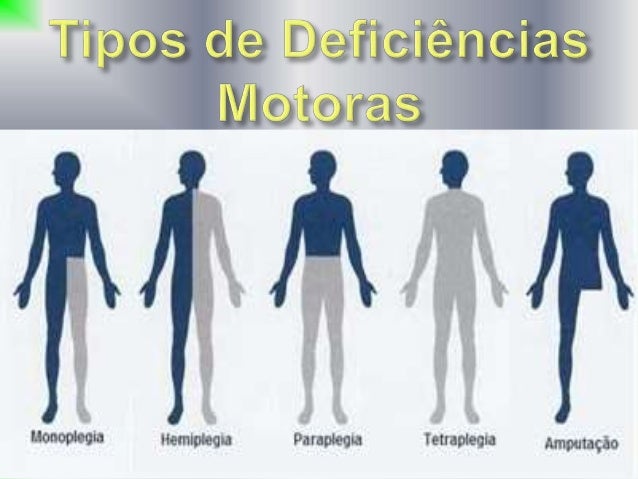 Deficiências motoras
