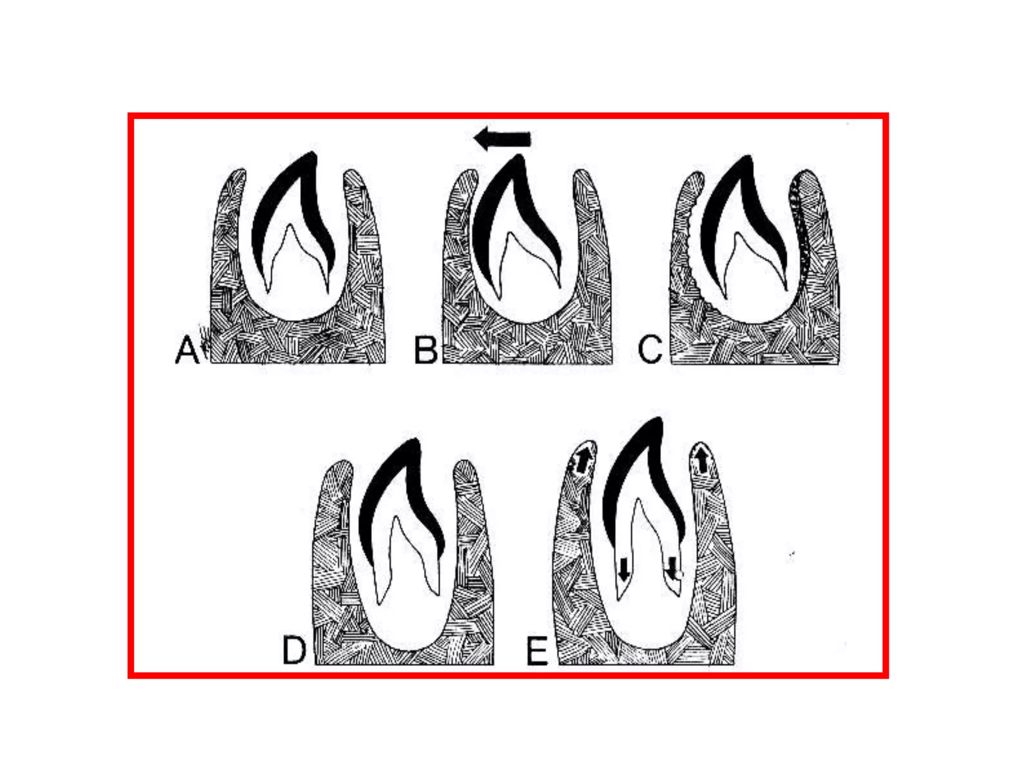 Define eruption of teeth & its phases | PPTX