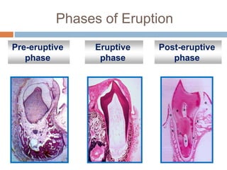 Define eruption of teeth & its phases | PPTX