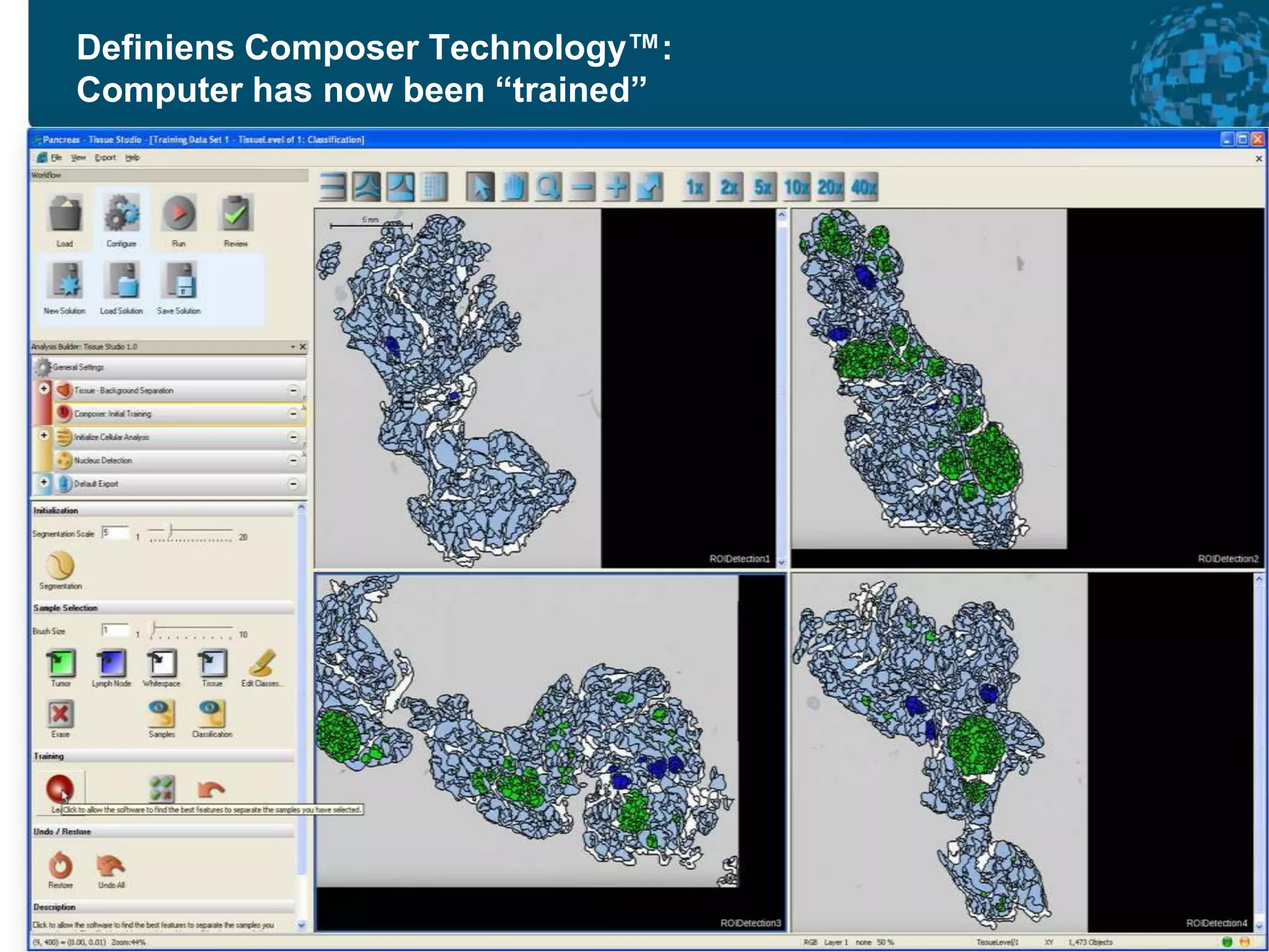Definiens Tissue Studio Advanced Digital Pathology Image Analysis ...
