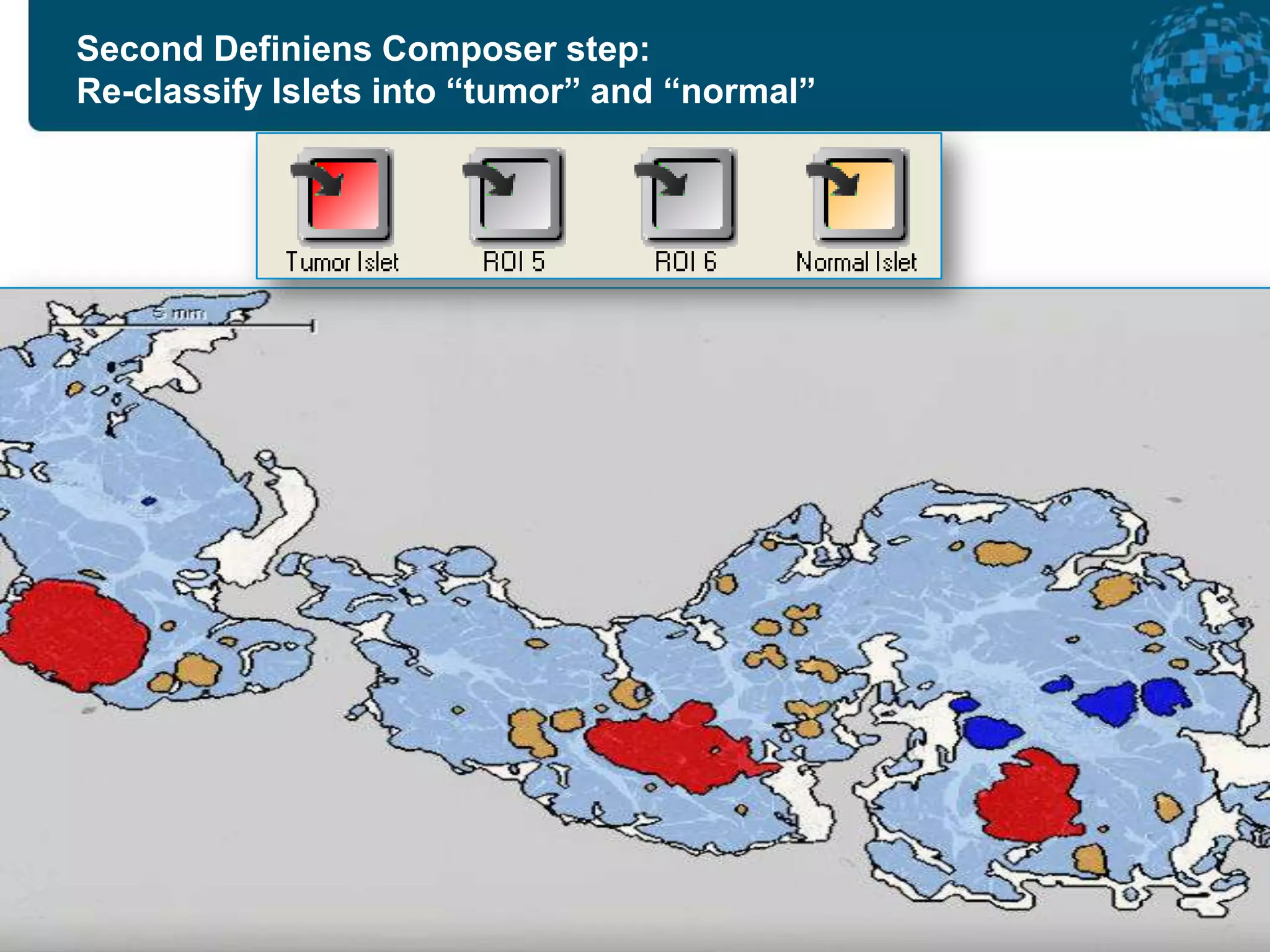 Definiens Tissue Studio Advanced Digital Pathology Image Analysis ...