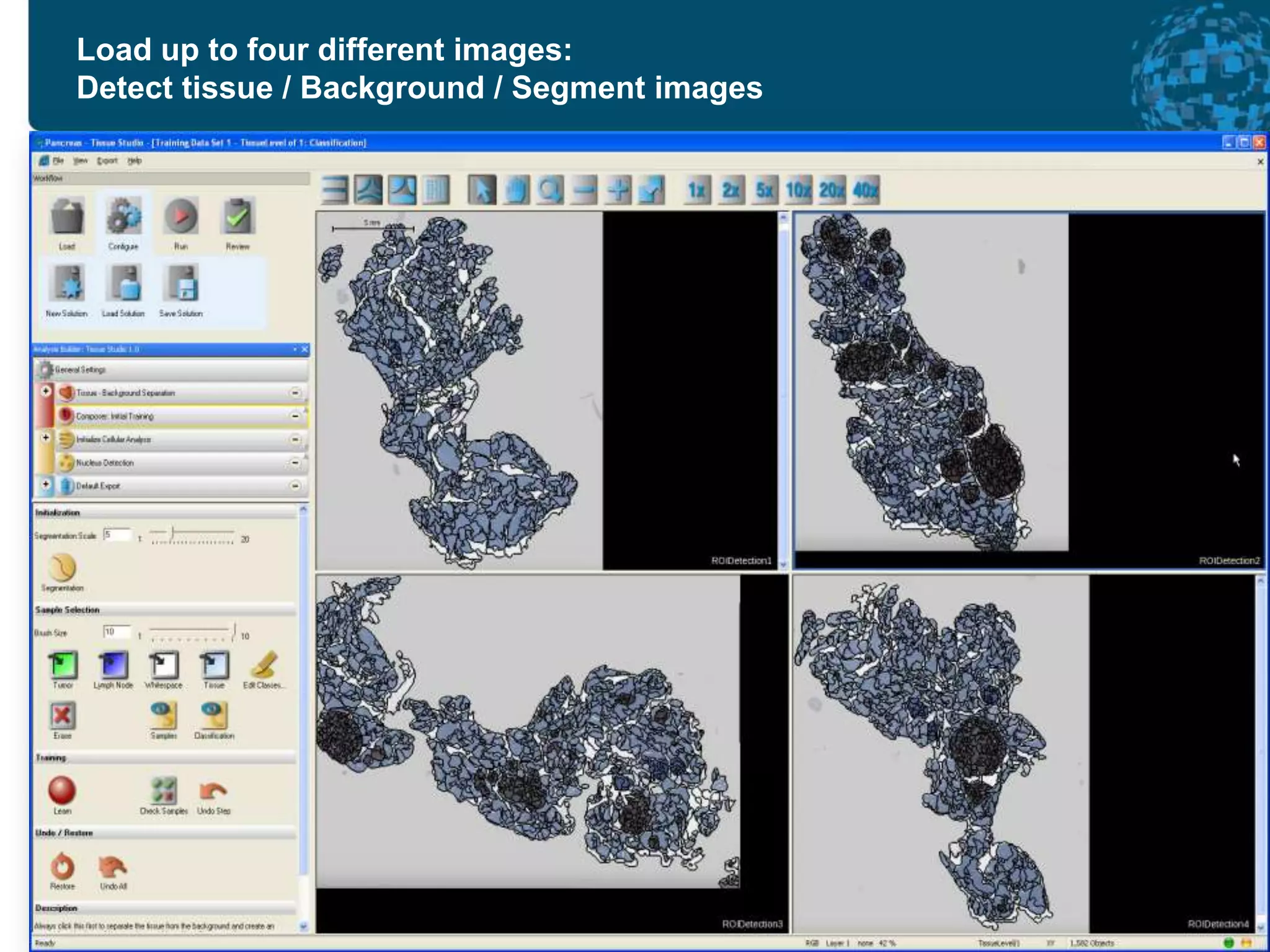 Definiens Tissue Studio Advanced Digital Pathology Image Analysis ...