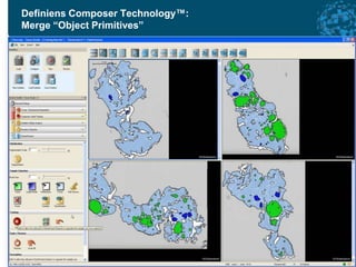 Definiens Tissue Studio Advanced Digital Pathology Image Analysis ...