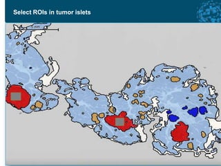 Definiens Tissue Studio Advanced Digital Pathology Image Analysis Solution | PPTX