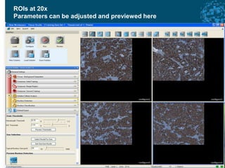Definiens Tissue Studio Advanced Digital Pathology Image Analysis ...