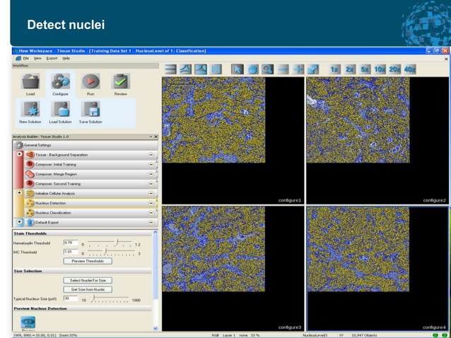 Definiens Tissue Studio Advanced Digital Pathology Image Analysis Solution | PPTX
