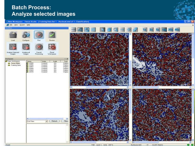 Definiens Tissue Studio Advanced Digital Pathology Image Analysis Solution | PPTX