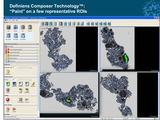 Definiens Tissue Studio Advanced Digital Pathology Image Analysis ...