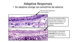 Defining adverse non adverse and adaptive responses in safety:risk ...