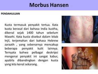 DEFINISI DAN KLASIFIKASI KUSTA INDO.pptx