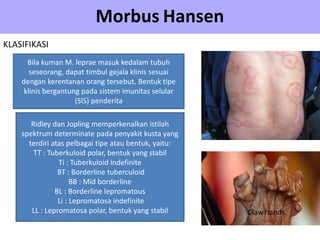 DEFINISI DAN KLASIFIKASI KUSTA INDO.pptx