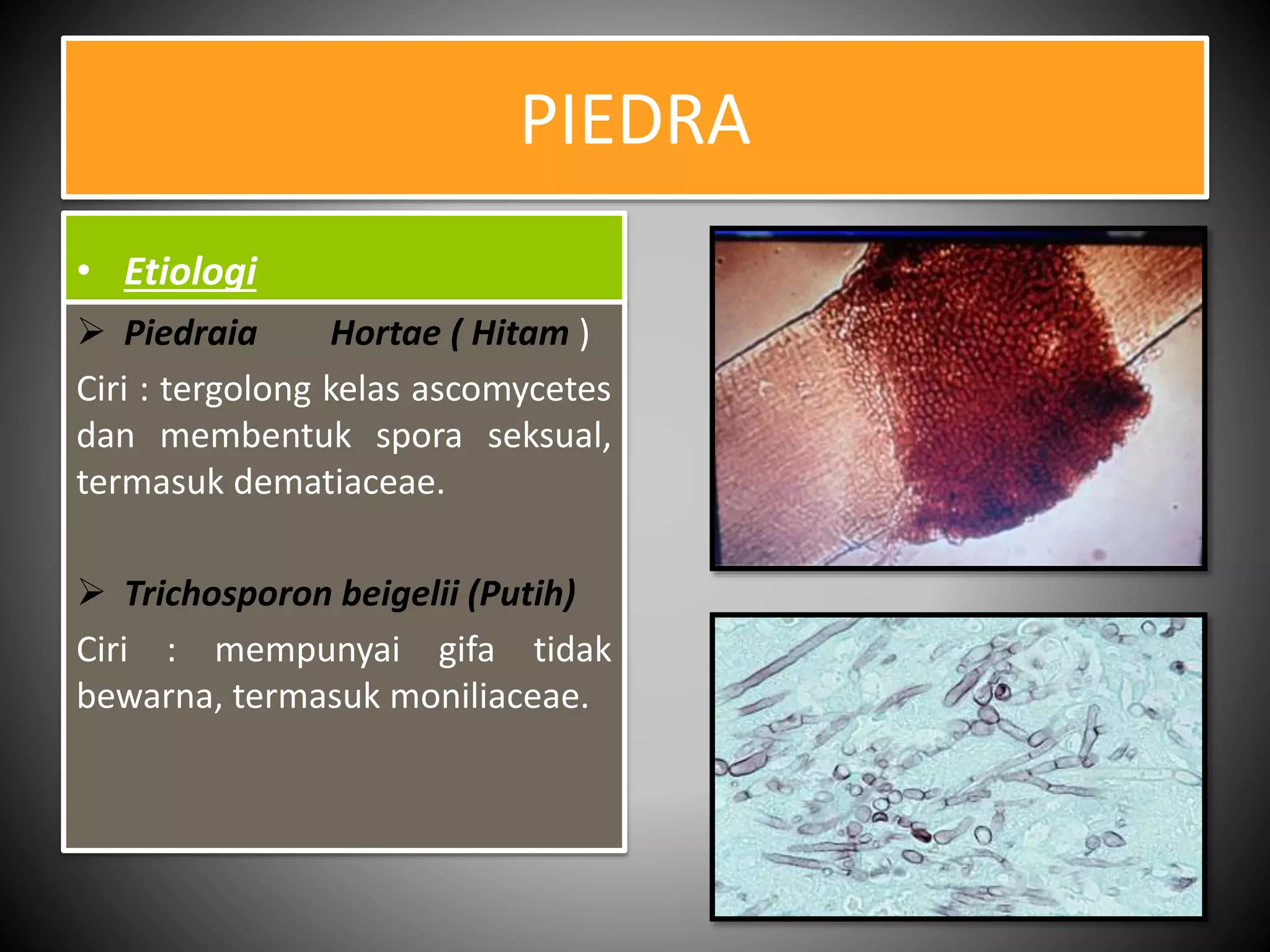 Definisi etiologi non dermato dan dermato | PPTX
