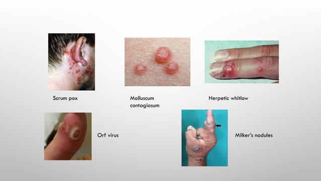 DEFINITION AND TYPES OF CUTANEOUS AND SUBCUTANEOUS INFECTIONS.pptx