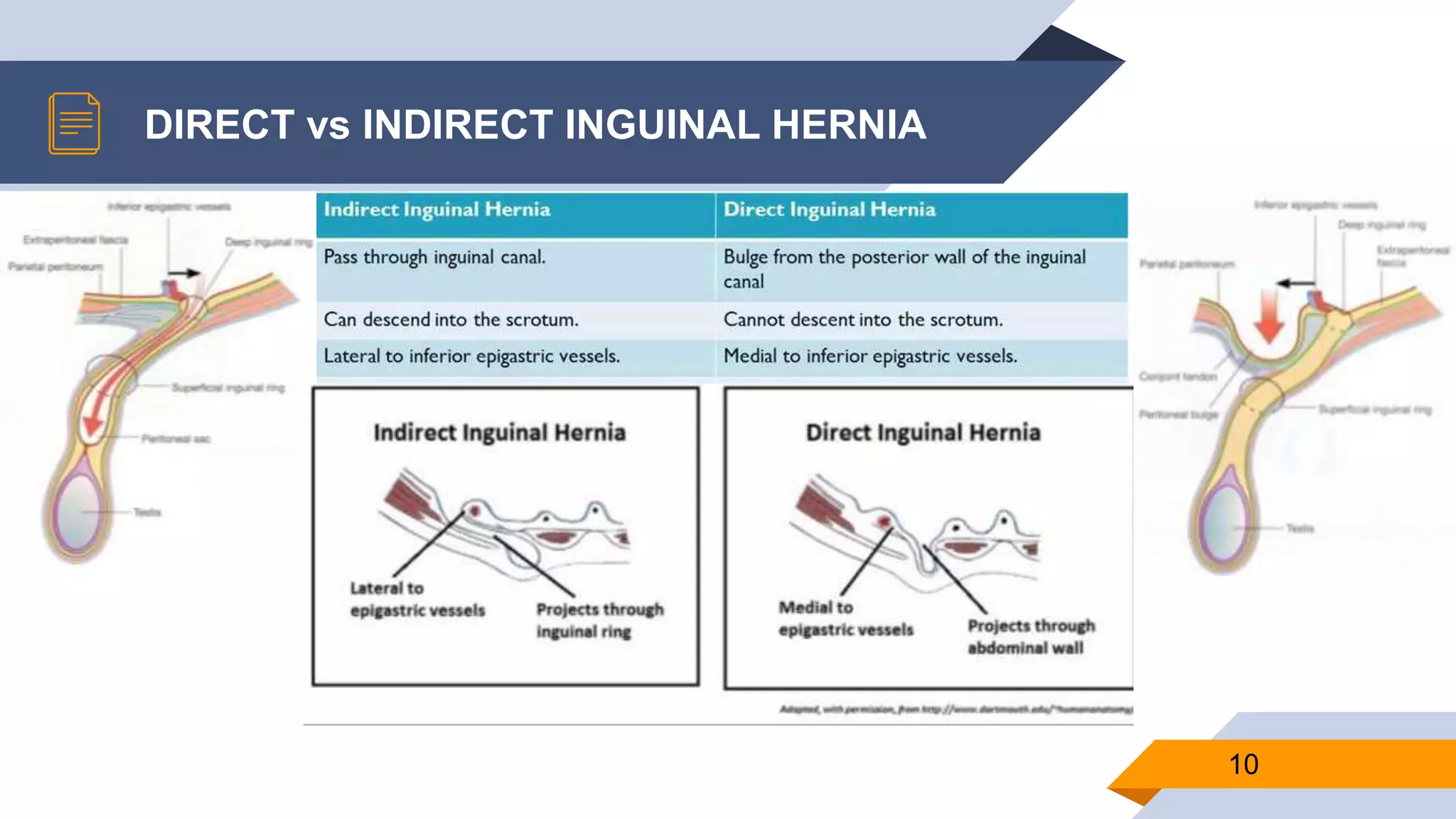 Definition and types of hernia repair | PPTX