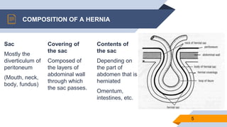 Definition and types of hernia repair | PPTX