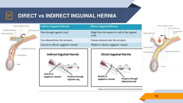 Definition and types of hernia repair