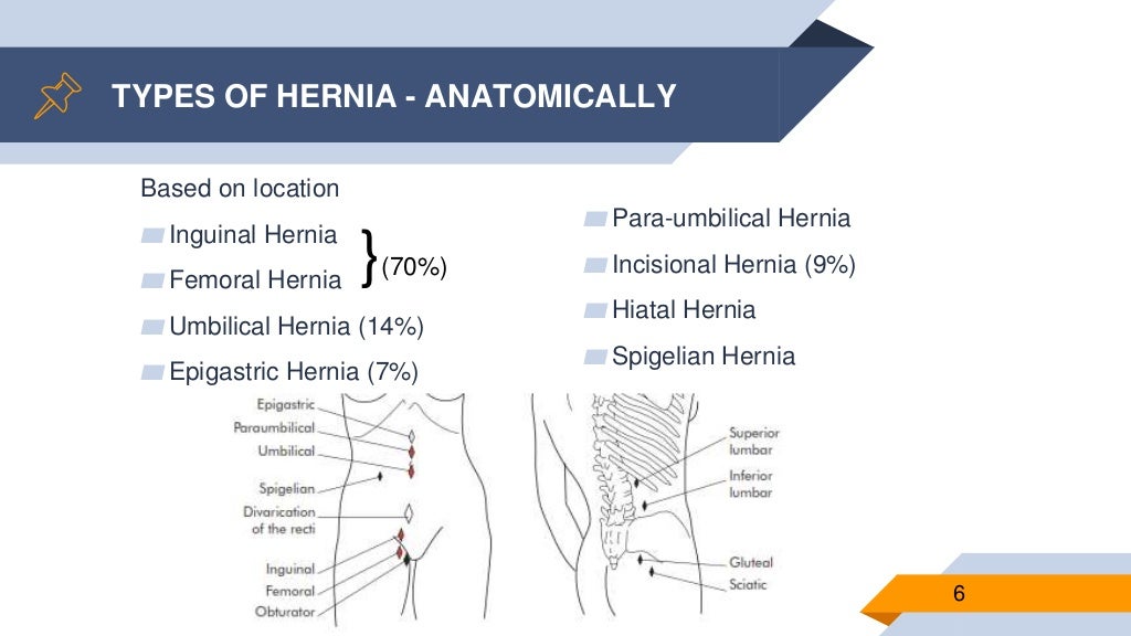Hernias Types