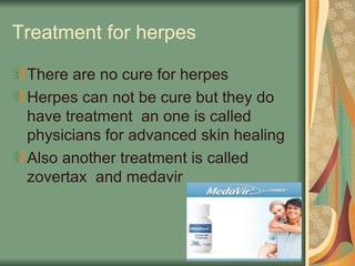 Definition of herpes | PPT