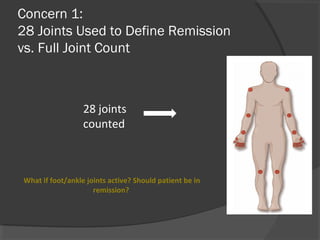 Definition of remission of ra | PPT