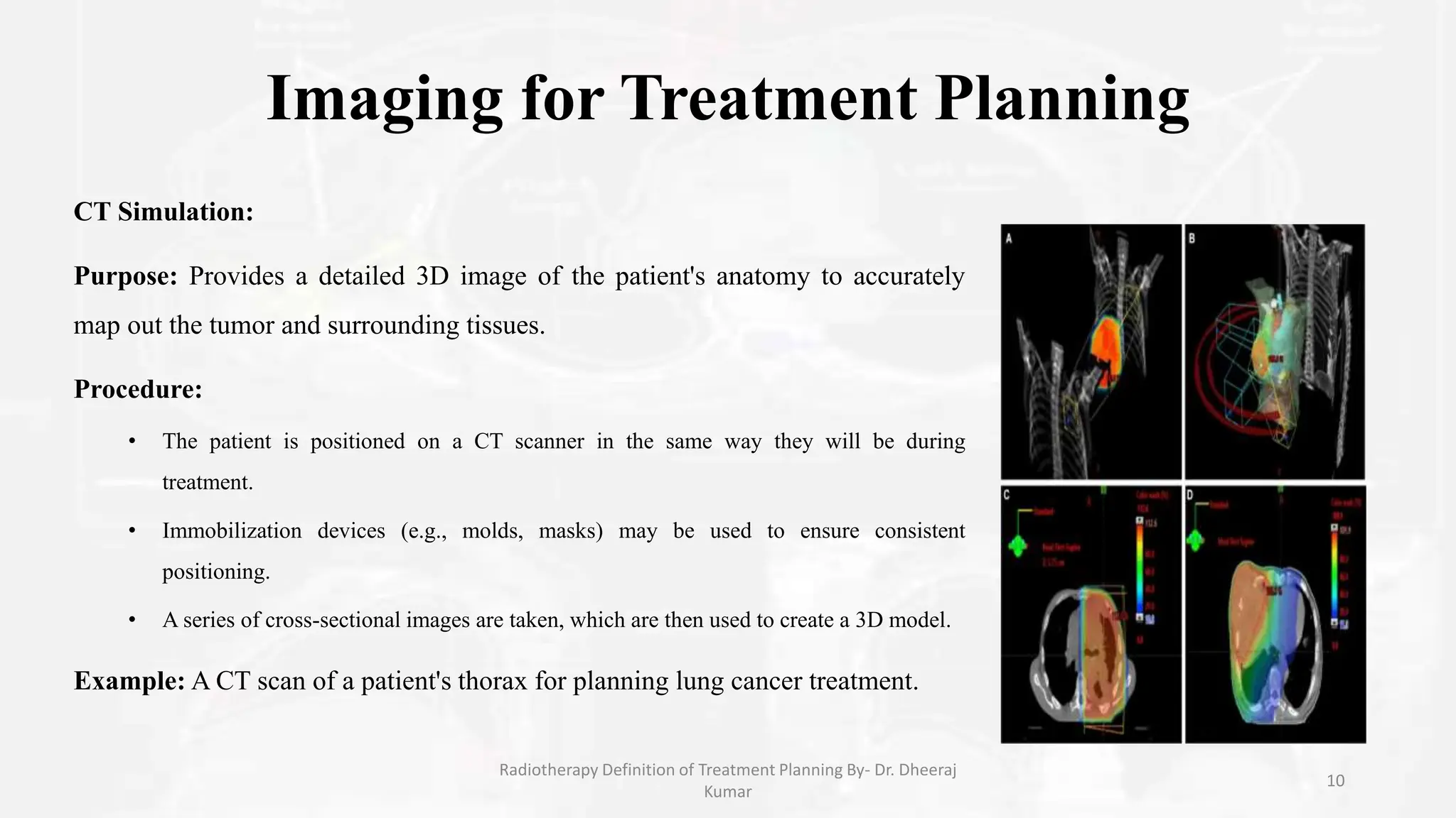 Definition of Radiotherapy Treatment Planning.pptx