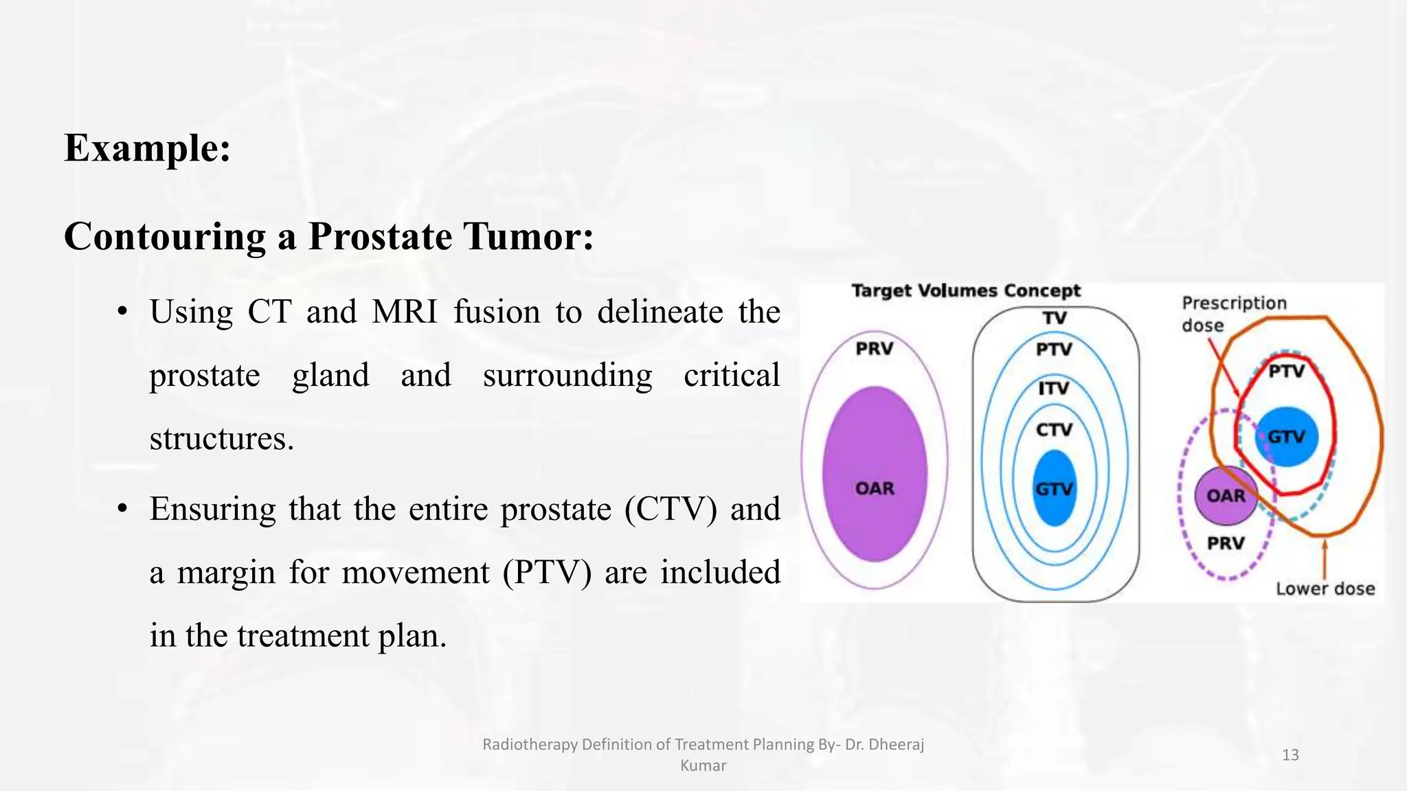 Definition of Radiotherapy Treatment Planning.pptx