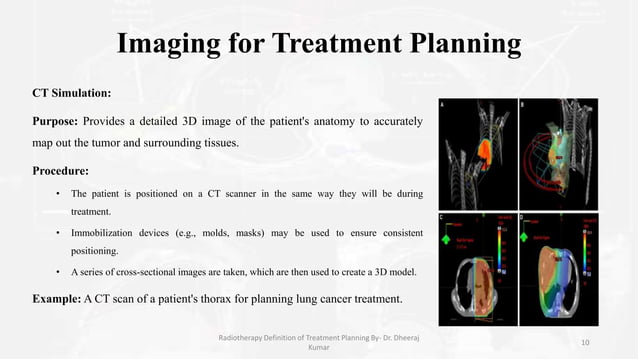 Definition of Radiotherapy Treatment Planning.pptx