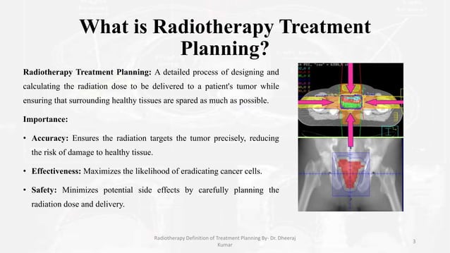 Definition of Radiotherapy Treatment Planning.pptx