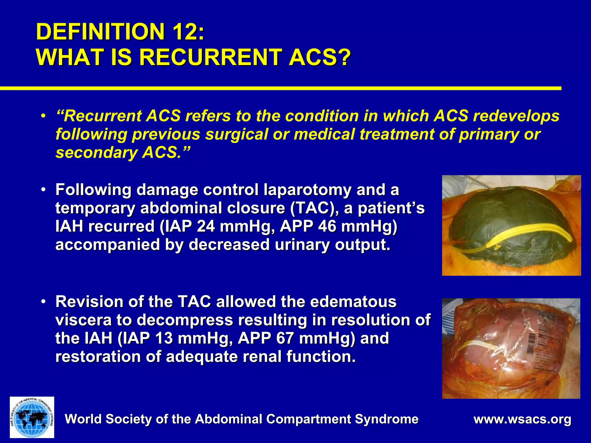 WSACS Definitions | PPT