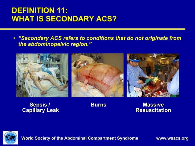 WSACS Definitions | PPT