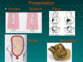 Definitions in obs lect | PPT