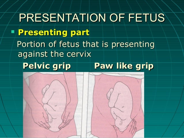 Definitions in obs lect