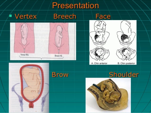 Definitions in obs lect