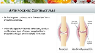 definitionsoftermsrelatedtomobilityandstretching-151018110910-lva1 ...