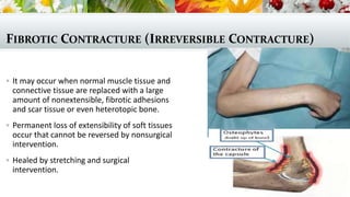 definitionsoftermsrelatedtomobilityandstretching-151018110910-lva1 ...