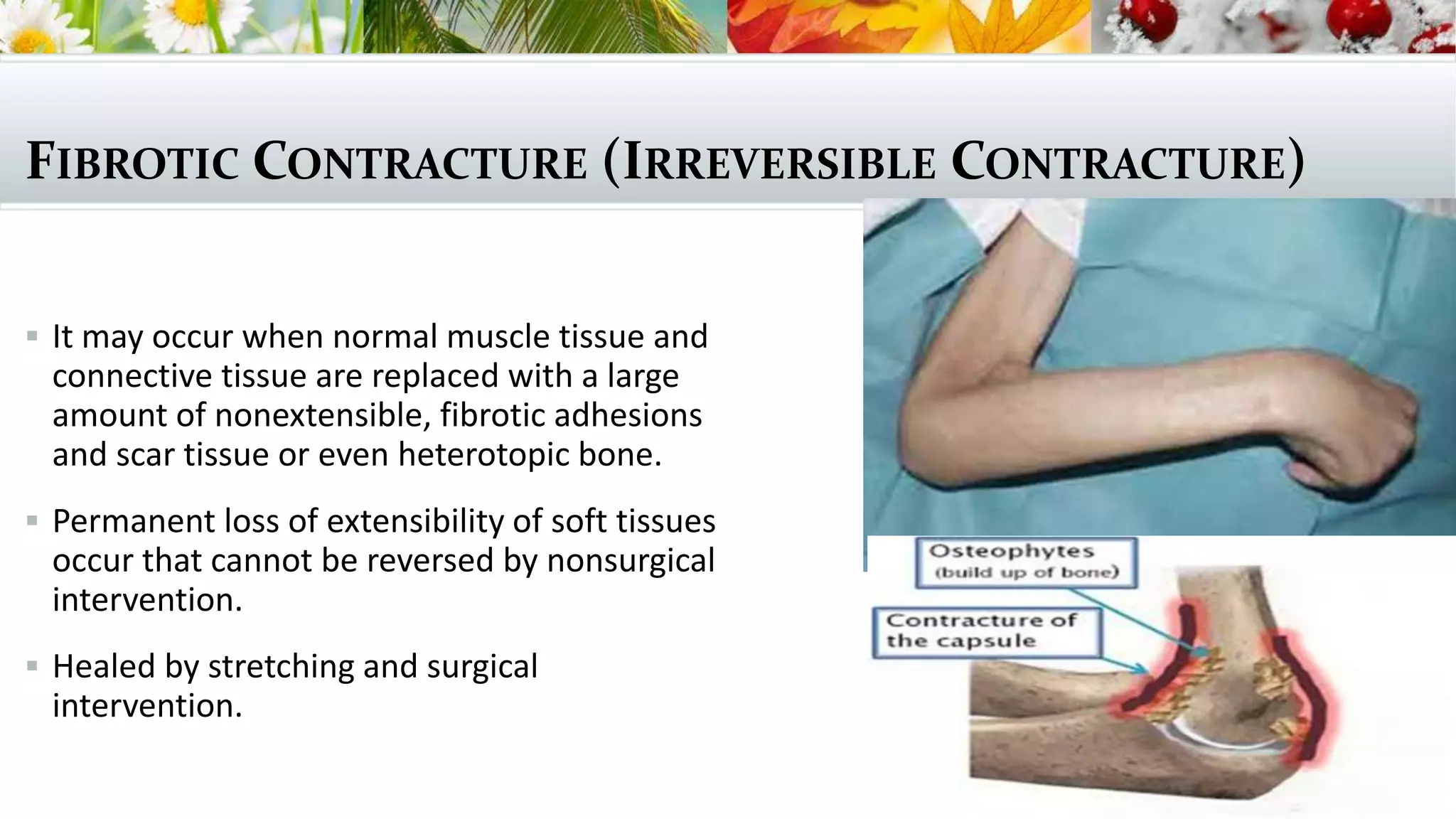 Definitions of terms related to mobility and stretching | PPTX