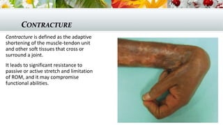 Definitions of terms related to mobility and stretching | PPT